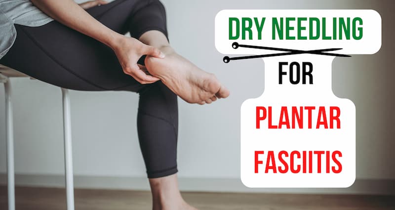 Dry needling for plantar fasciitis : Cost, Procedure and Side Effects ...